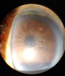 Glaucoma Specialist in Noida | Dr Sridevi Haldar | Dr.Haldar’s ...