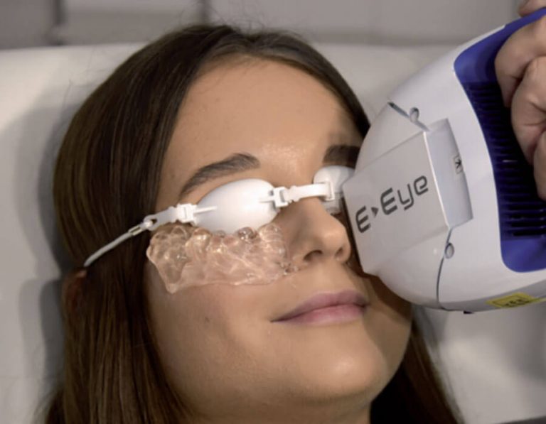 Intense Pulsed Light for Dry Eye Treatment at OrthoVision Clinic ...